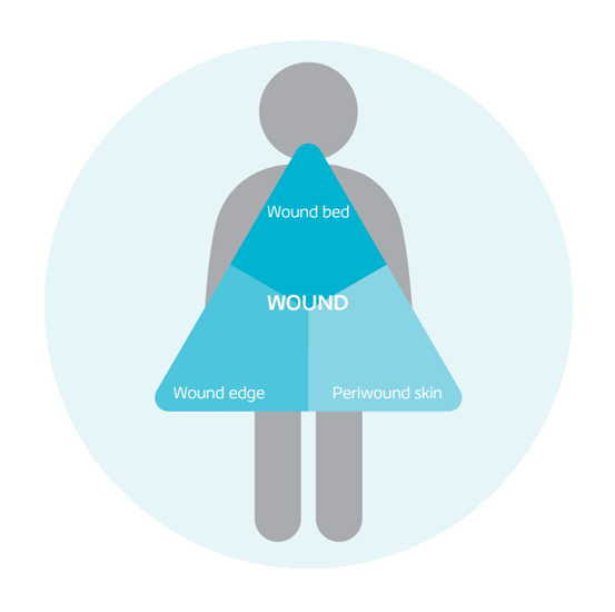 Tratamento de uma ferida traumática com hidrocoloides.